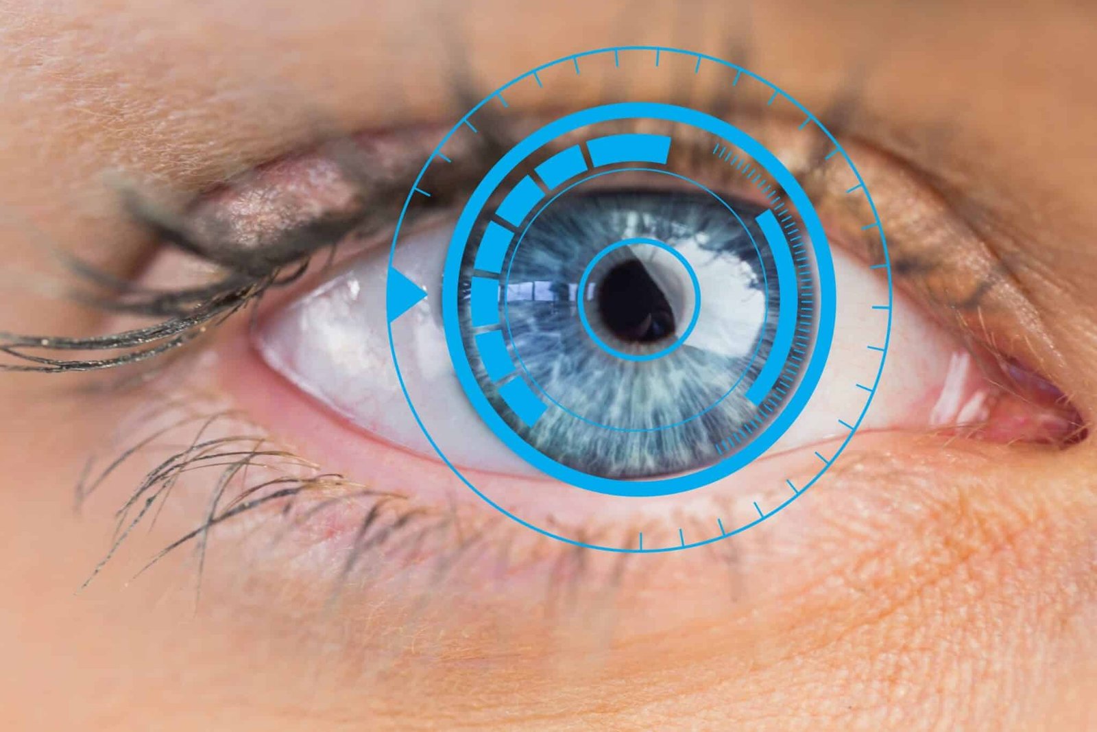 Bonne Vision de Loin et Presbytie : l'Implant sur 1 Œil